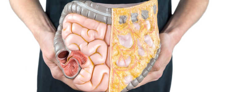 S Complexem F proti viscerálnímu tuku - yourself.care